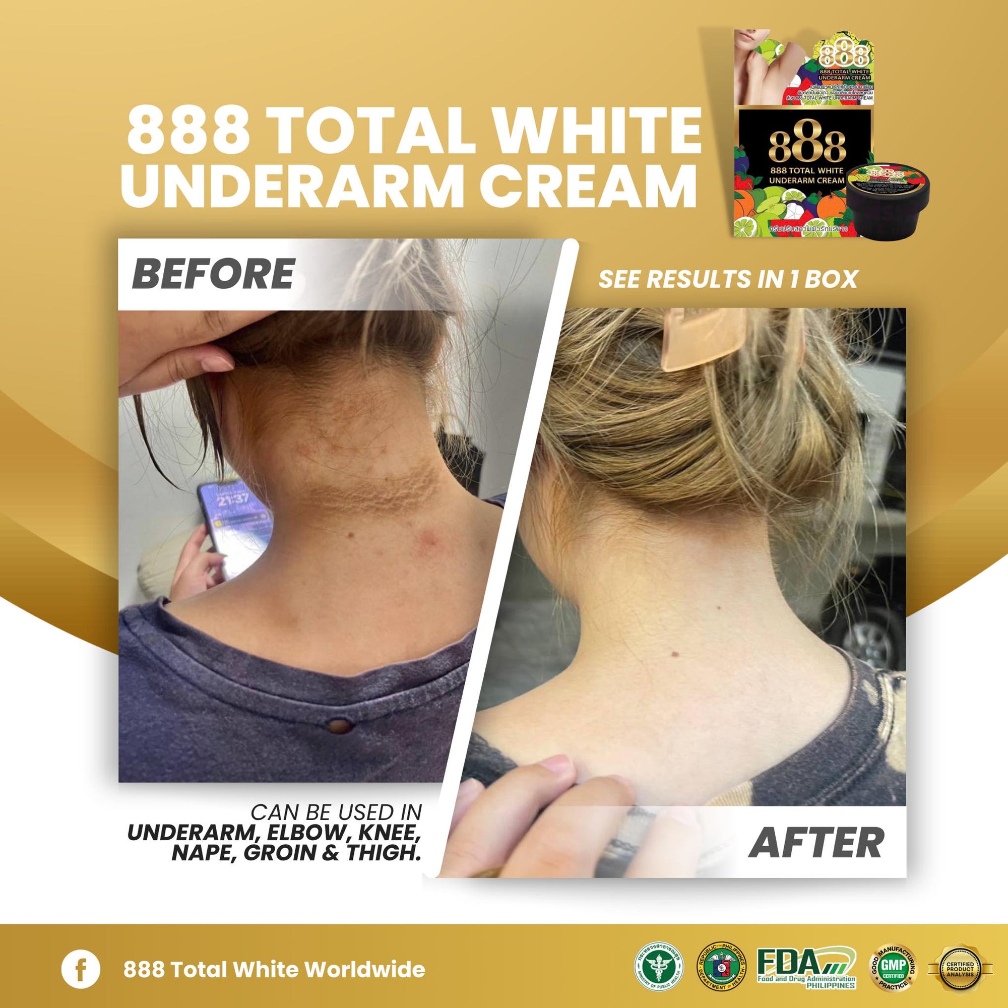 888 UNDERARM CREAM FROM THAILAND - The Beauty Cart
